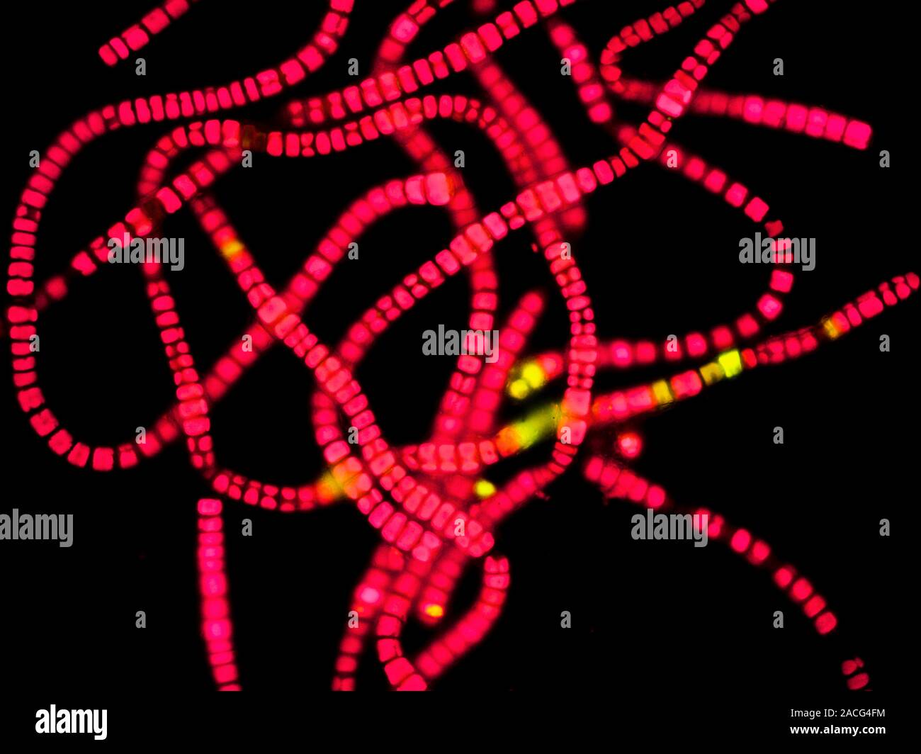 Green algae. Fluorescent light micrograph of the green filamentous alga ...