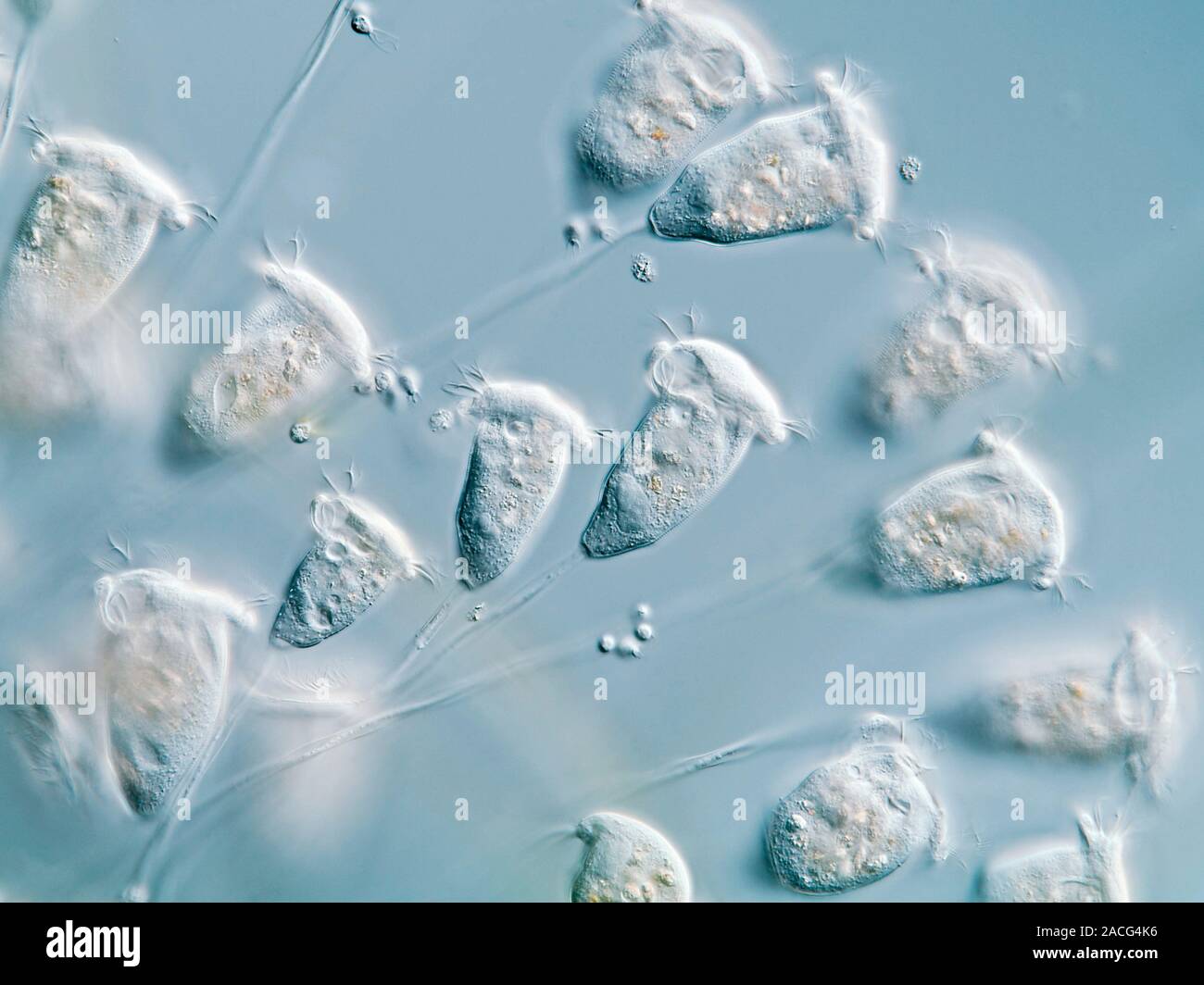Vorticella protozoa. Differential interference contrast micrograph of a ... Vorticella protozoa. Differential interference contrast micrograph of a ...