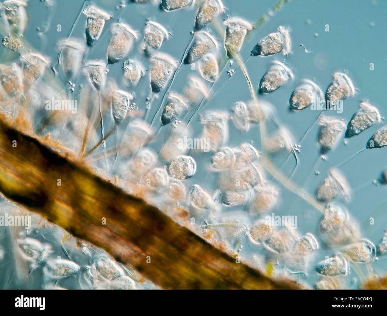 Vorticella protozoa. Differential interference contrast micrograph of a ... Vorticella protozoa. Differential interference contrast micrograph of a ...