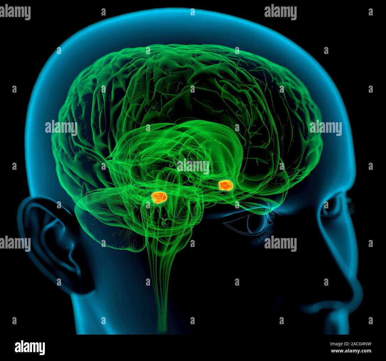 Amygdala in the brain. Computer artwork of a person's head showing the ...
