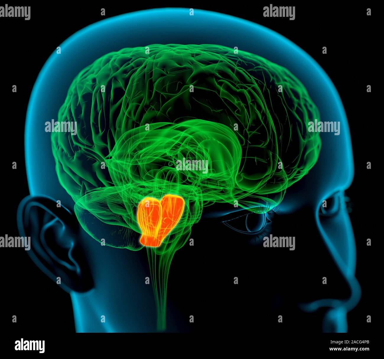 Midbrain in the brain. Computer artwork of a person's head showing the ...