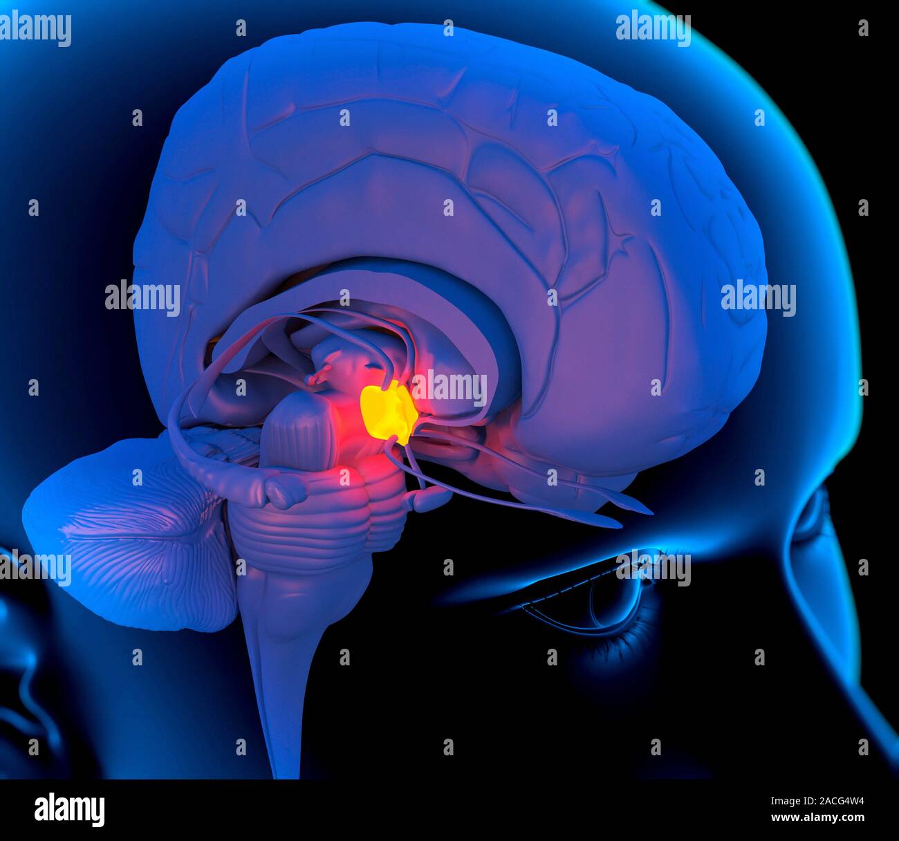 Hypothalamus in the brain. Computer artwork of a person's head showing ...