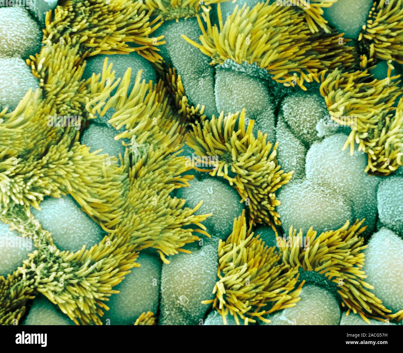 Trachea lining, coloured scanning electron micrograph (SEM). The ...