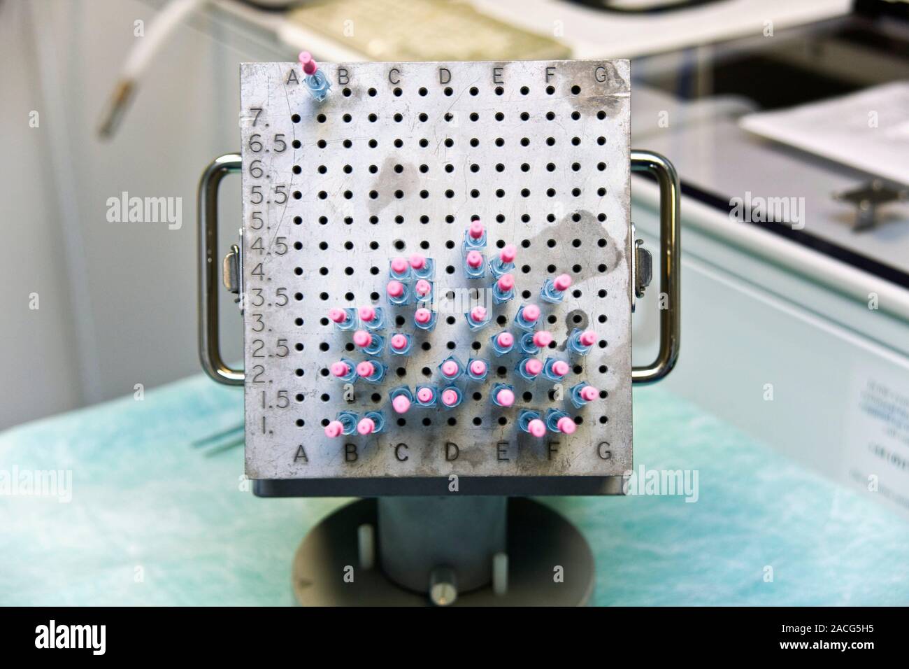Prostate cancer radiotherapy equipment. Lead-lined box being used to ...
