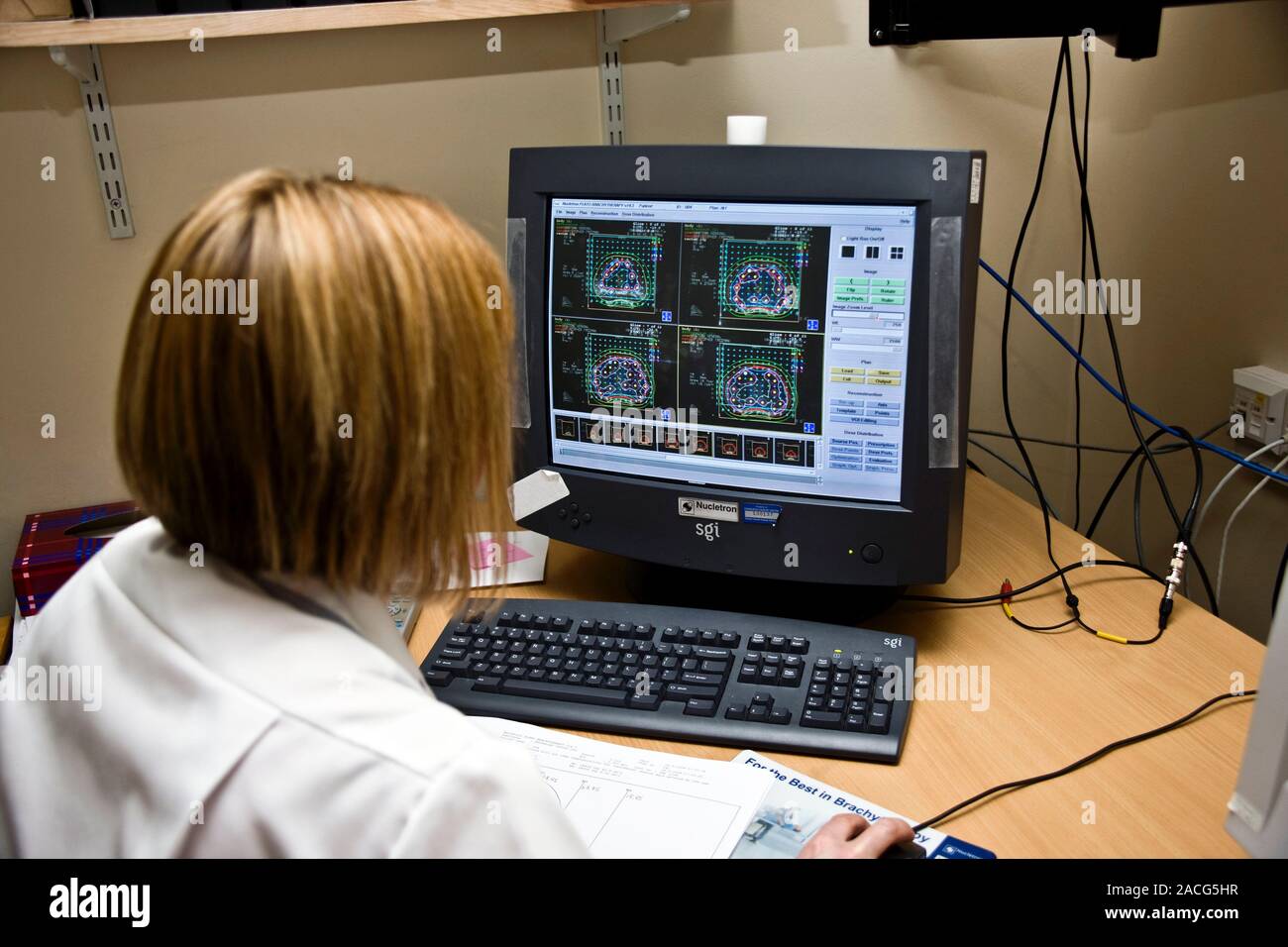 Prostate cancer radiotherapy planning. Radiologist examining the ...
