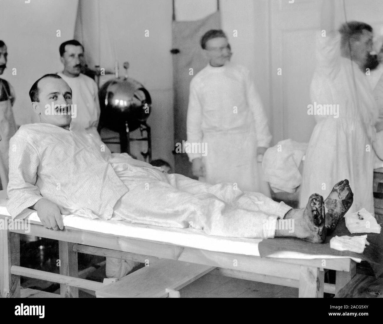 Trench foot, First World War. This condition was caused by the ...