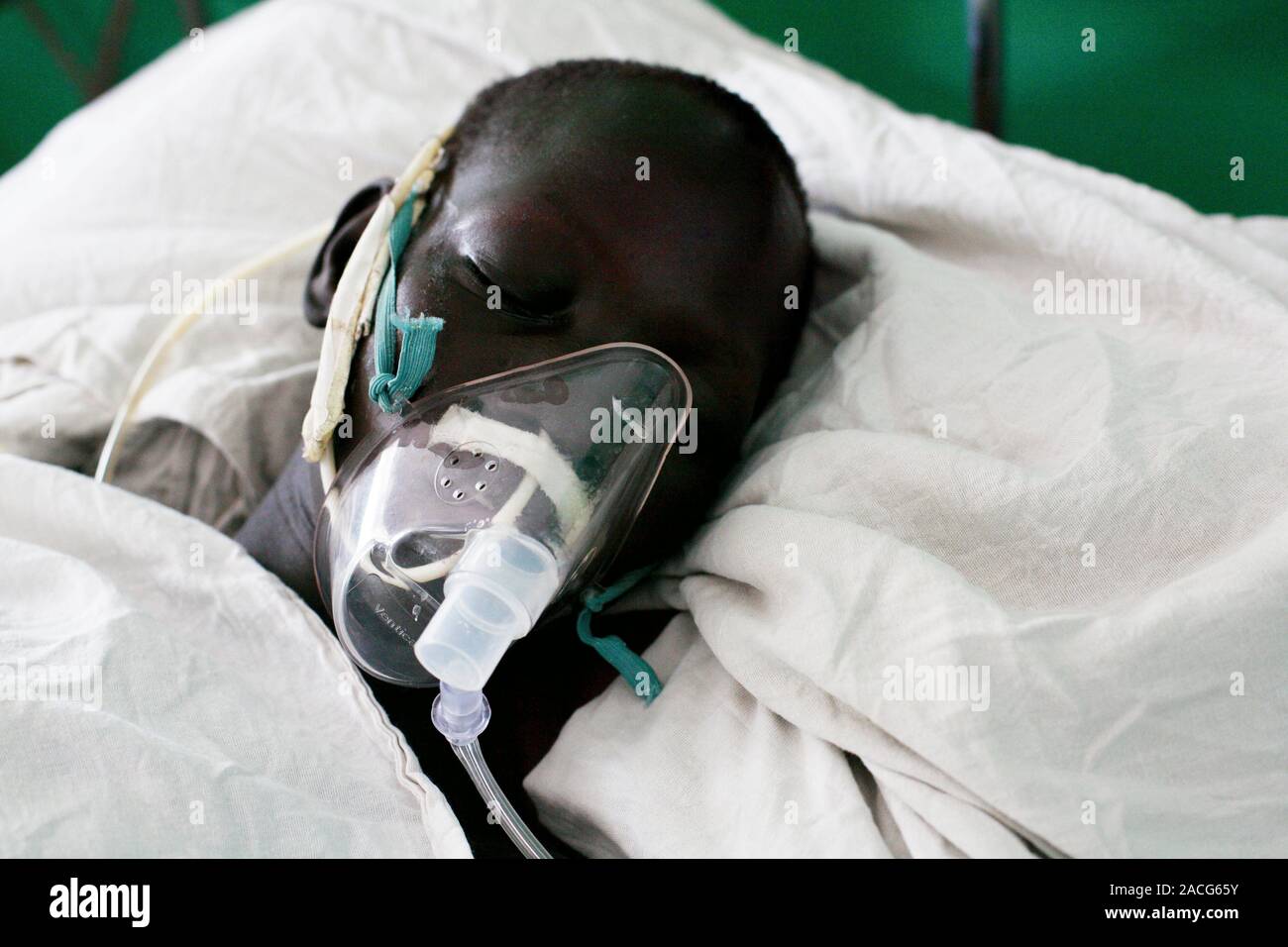 Hospital patient. The patient is sedated or sleeping, and is using an ...