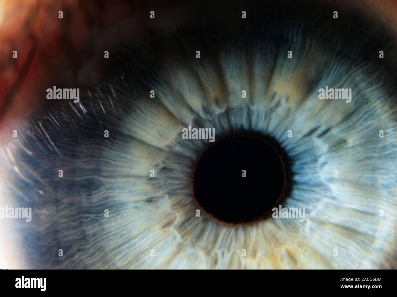 Human eye for cornea harvesting. Close-up of the right eyeball of a ...