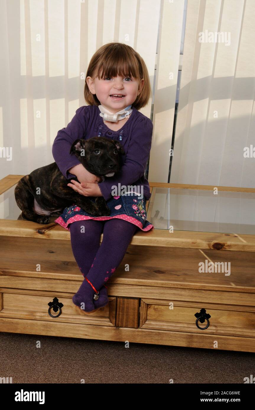 Child with tracheostomy. Young girl aged 2 1/2 years with a permanent ...