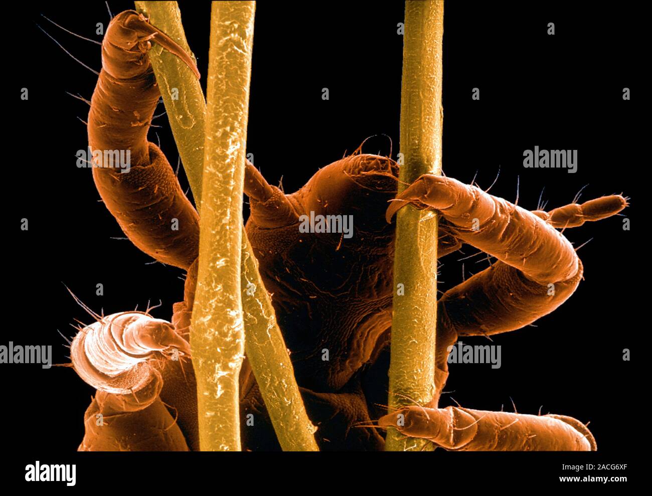 Head louse. Coloured scanning electron micrograph (SEM) of a head louse ...