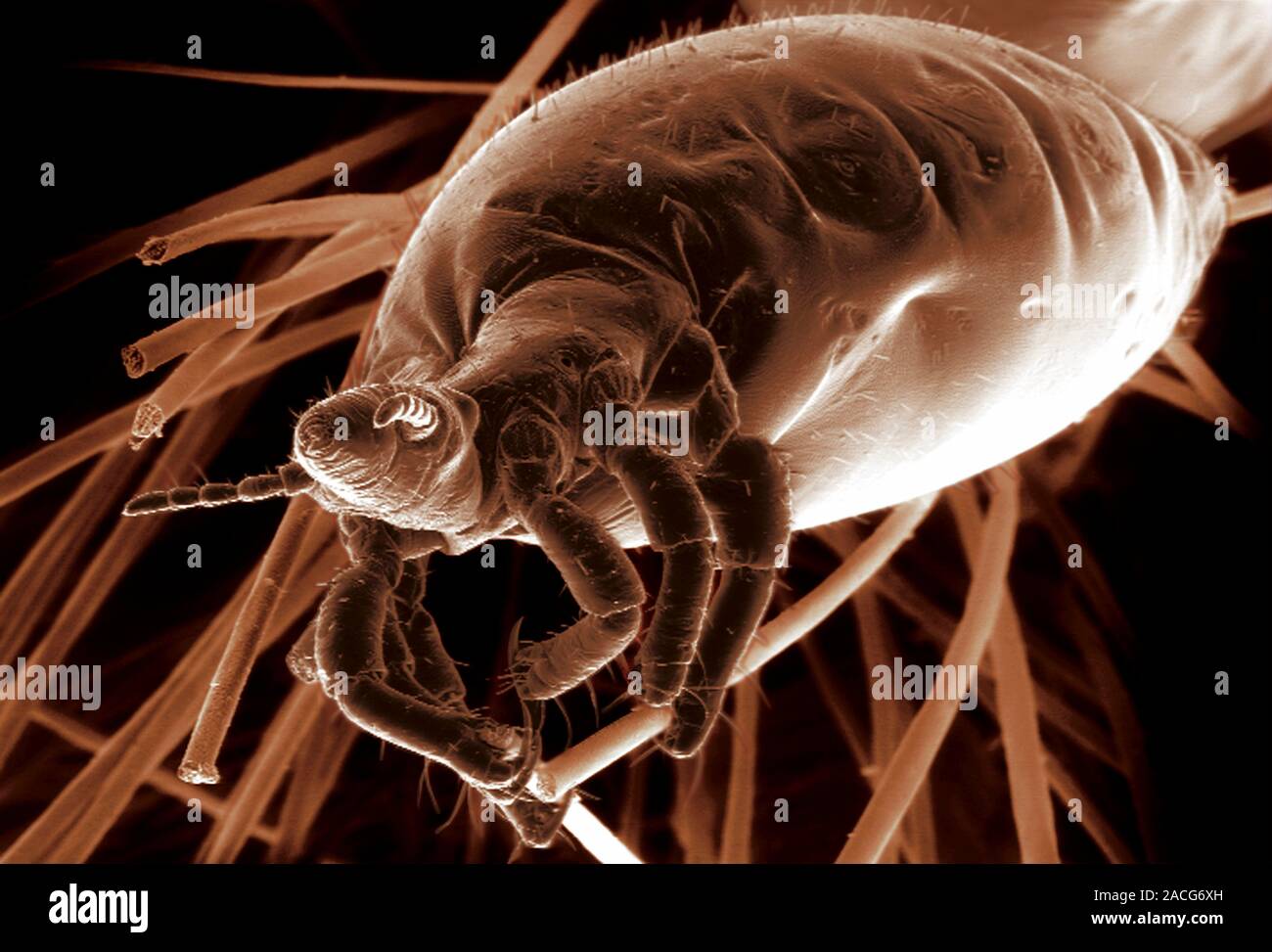 Head louse. Coloured scanning electron micrograph (SEM) of a female ...