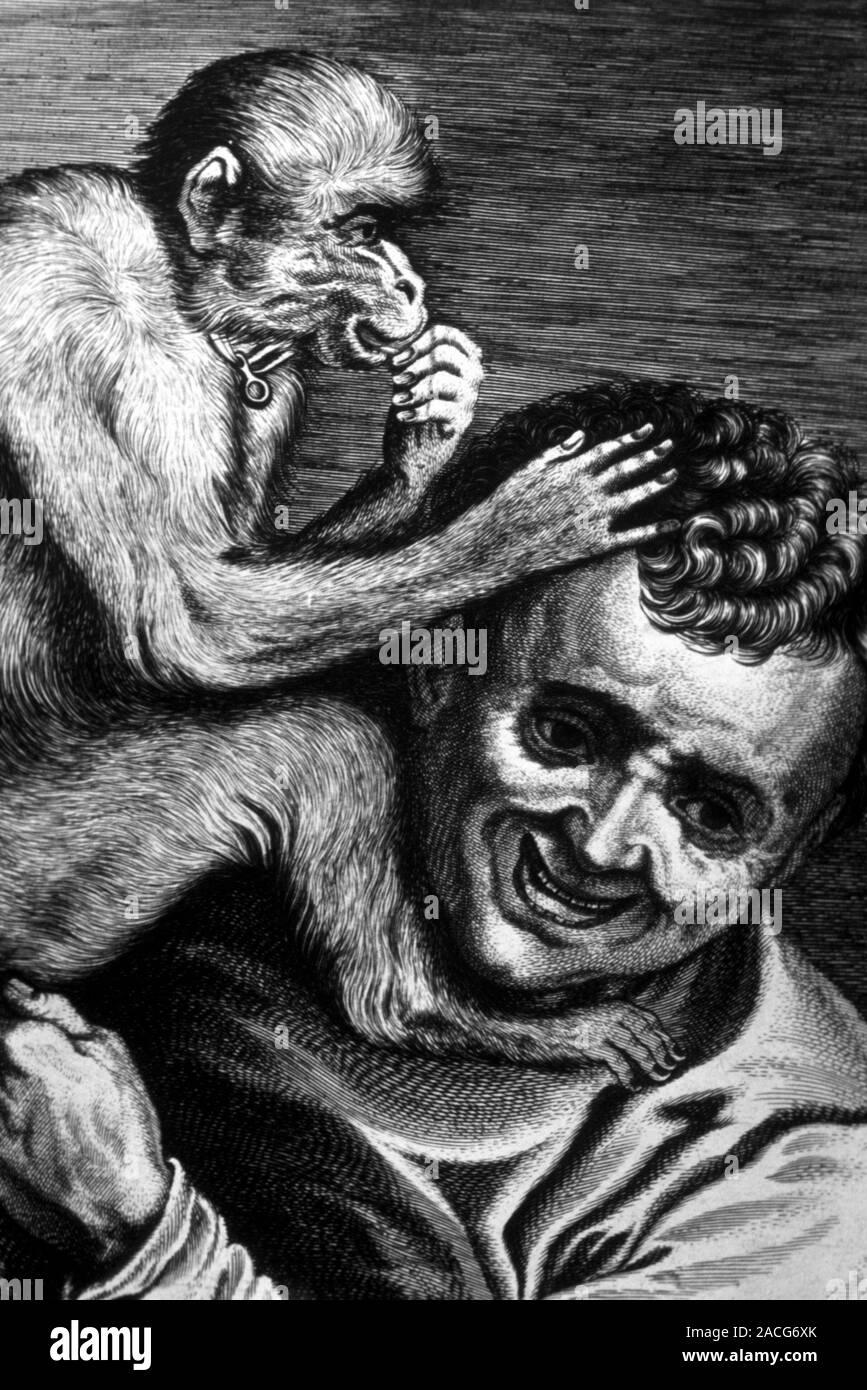 Historic head louse treatment. Historical artwork showing a monkey ...
