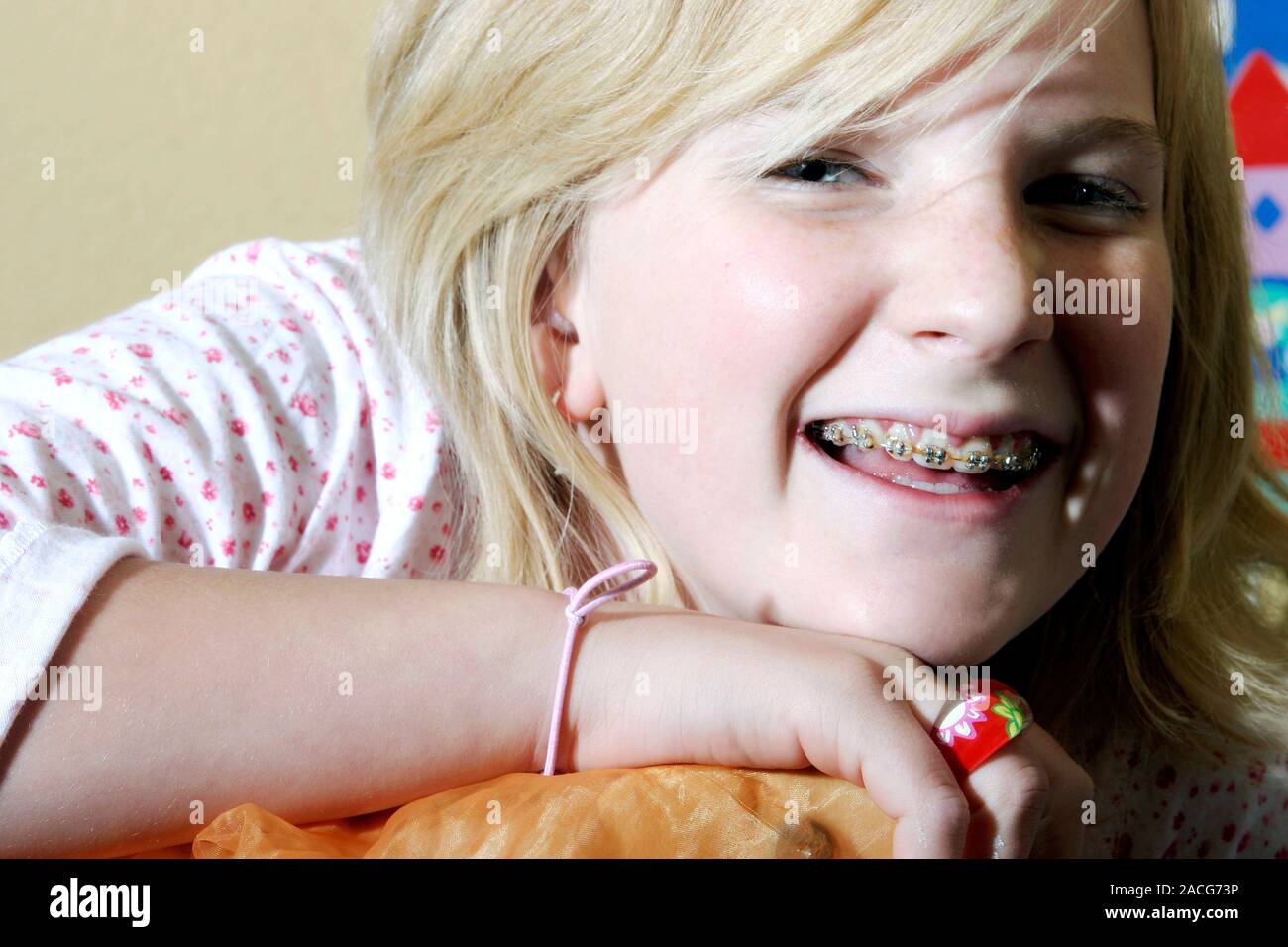 Teenager with braces Stock Photo - Alamy