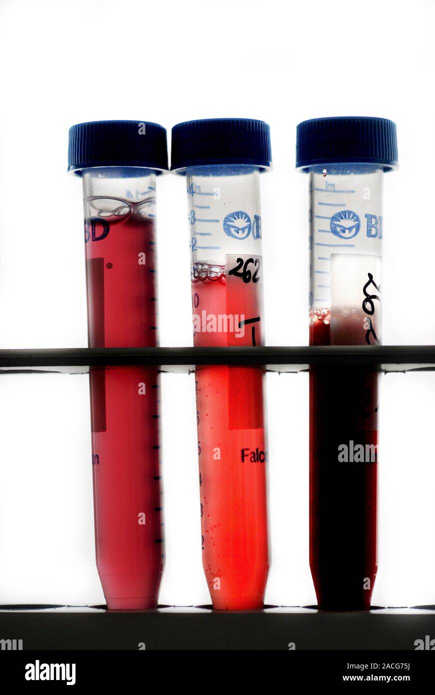 Blood cell manufacturing. Test tubes containing red blood cells ...