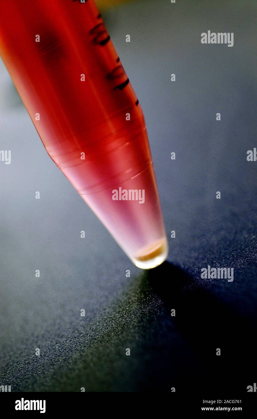 Blood cell manufacturing. Tube containing red blood cells that have ...