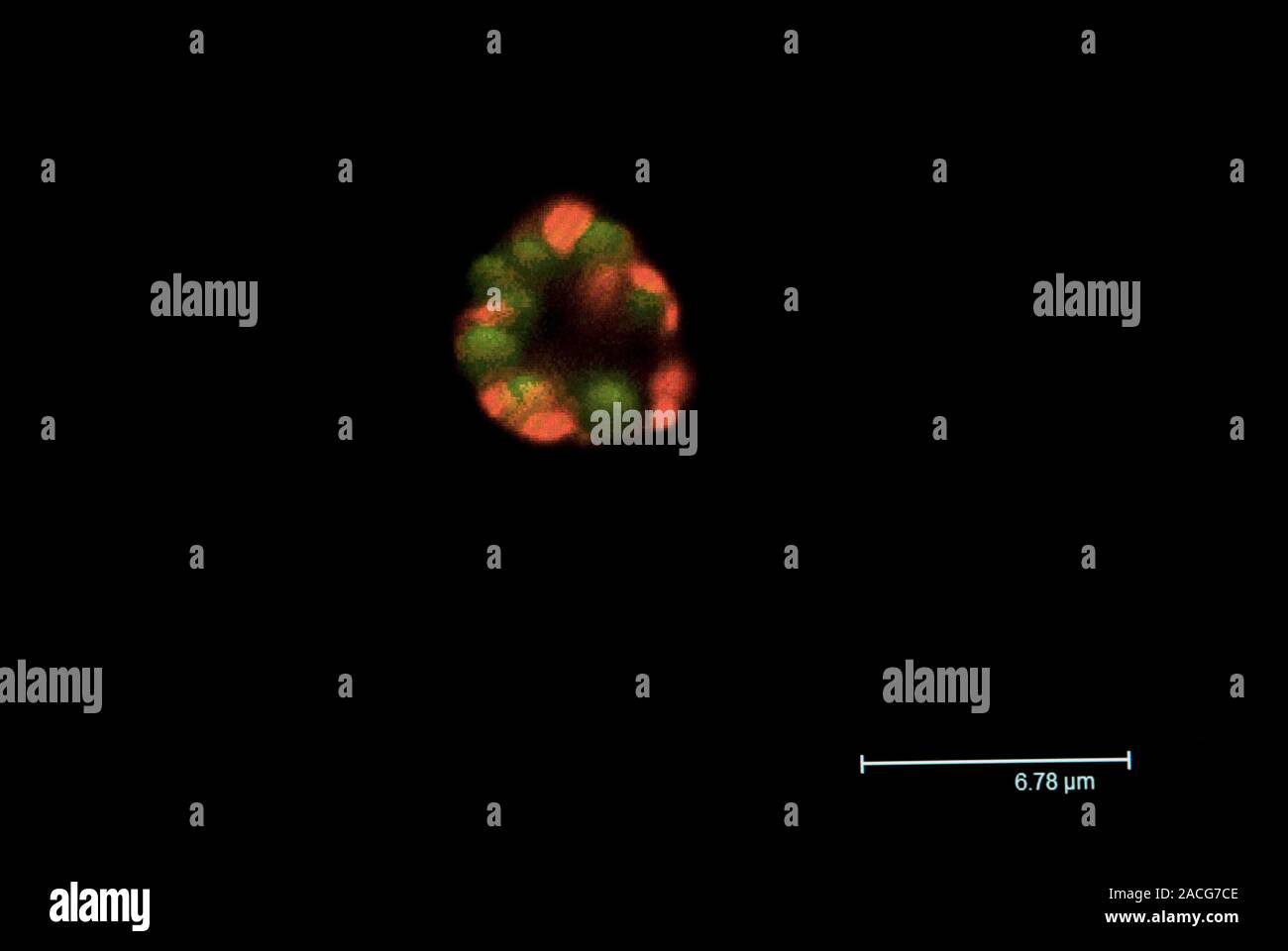 Microalgae lipids. Confocal light micrograph of lipids (fat) extracted ...