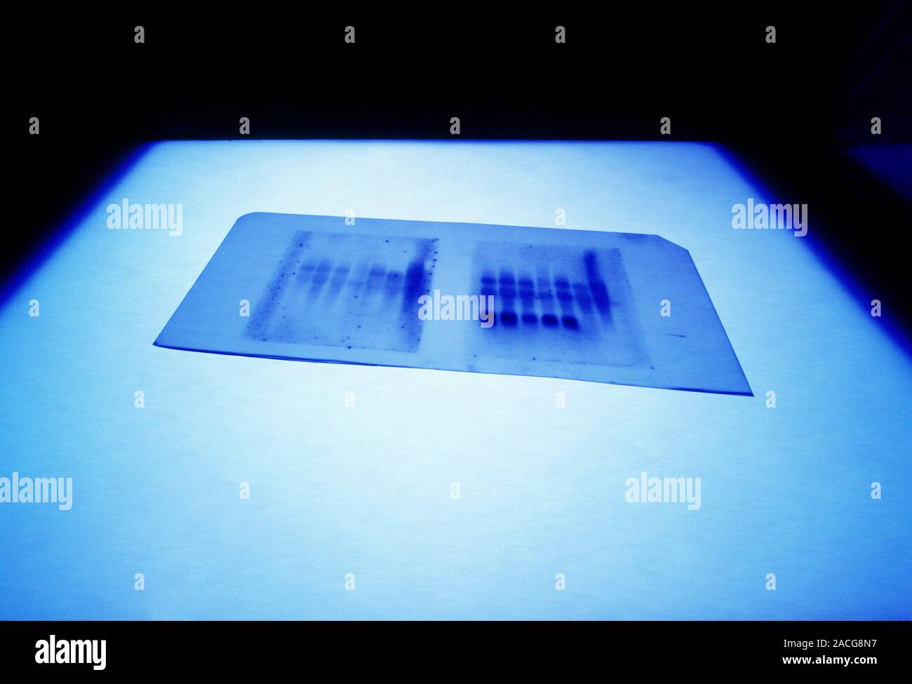 Plant-fungi research. Chromatographic analysis showing the genetic map ...