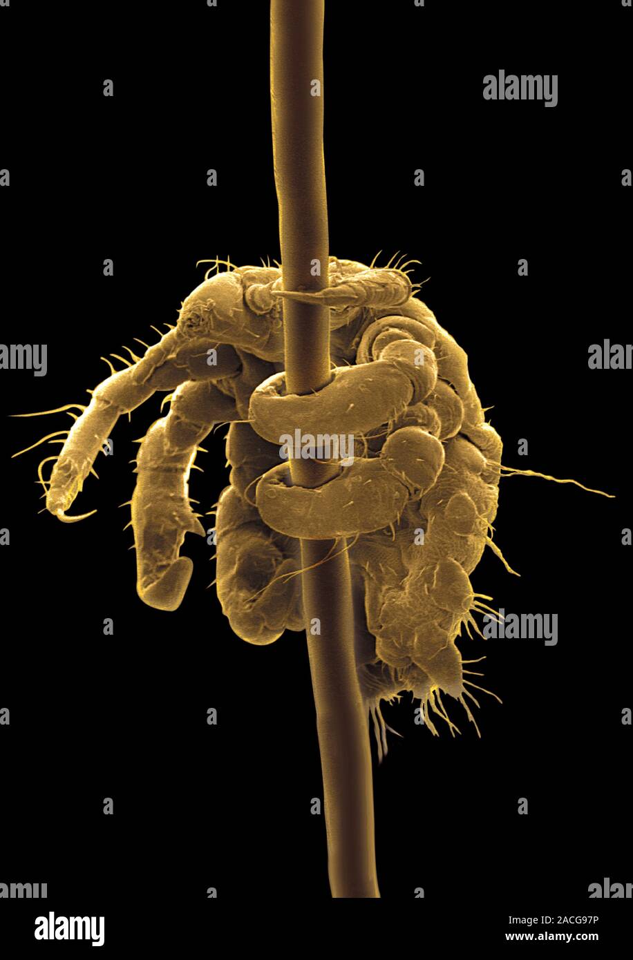 Head louse. Coloured scanning electron micrograph (SEM) of a head louse ...