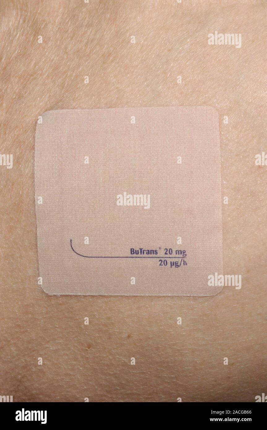 Close-up of a BuTrans transdermal patch on the skin in an 87 year old ...