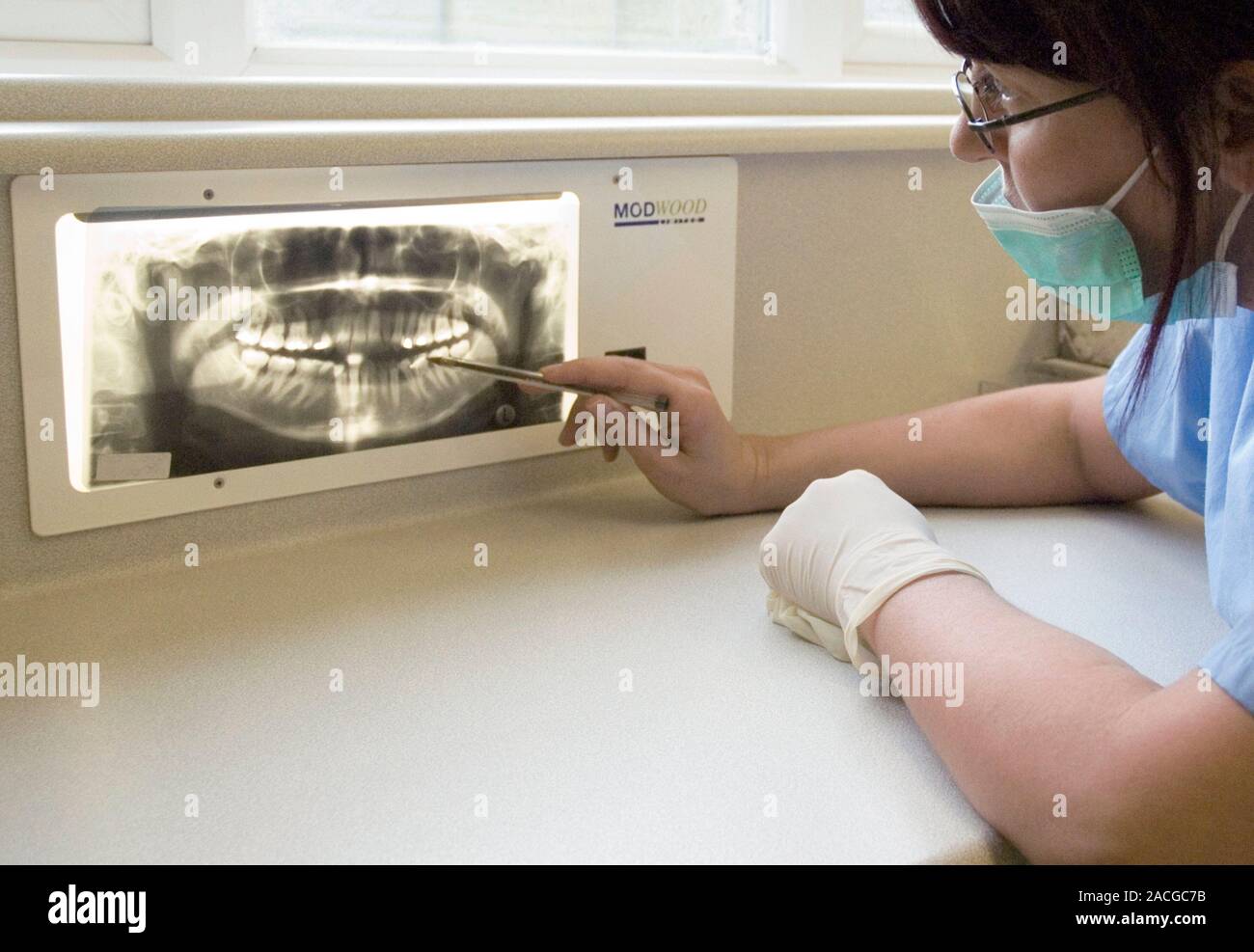 Dental examination. Dentist looking at an orthopantomogram X-ray of a ...