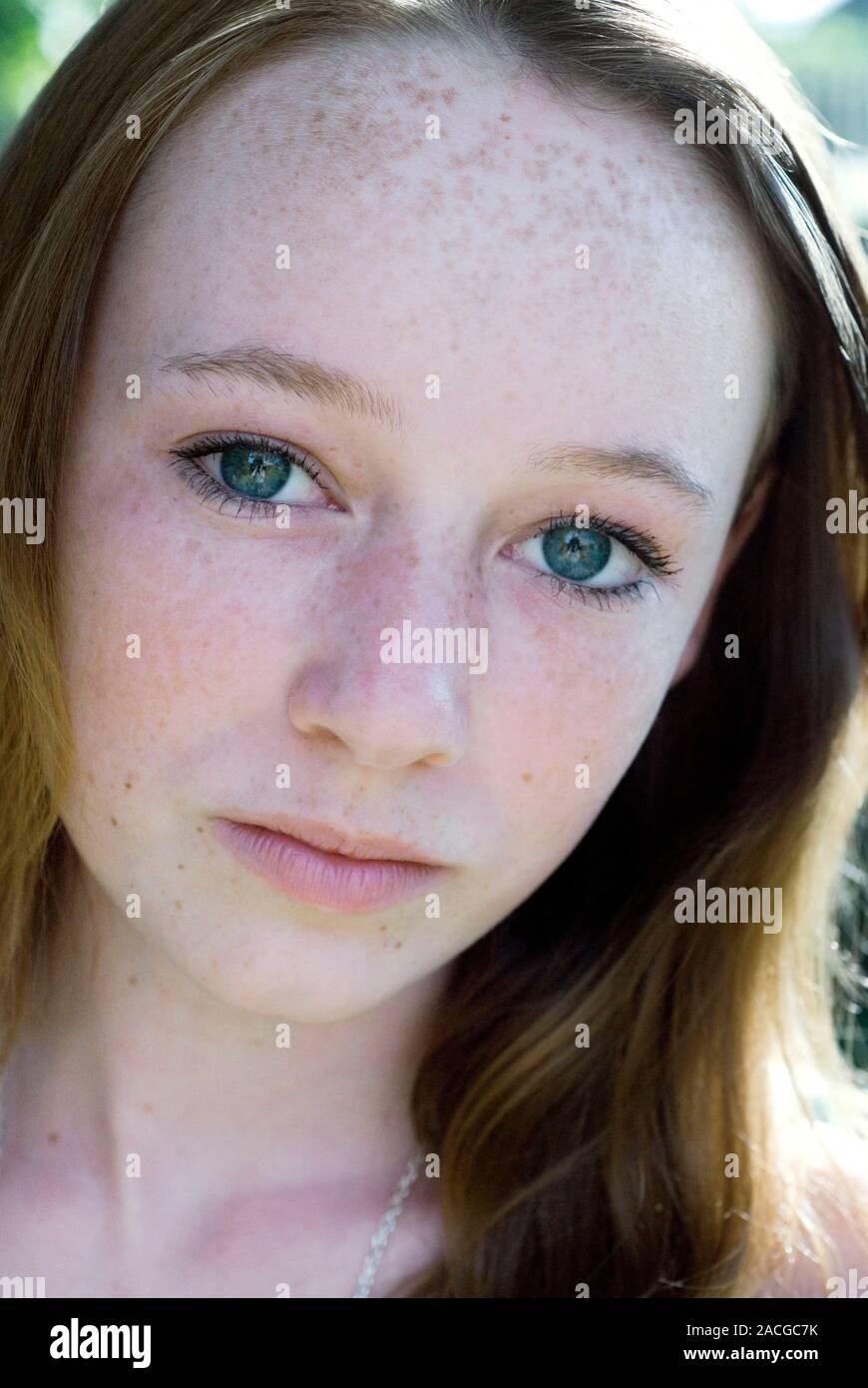 Teenager. Teenage girls with freckles Stock Photo - Alamy