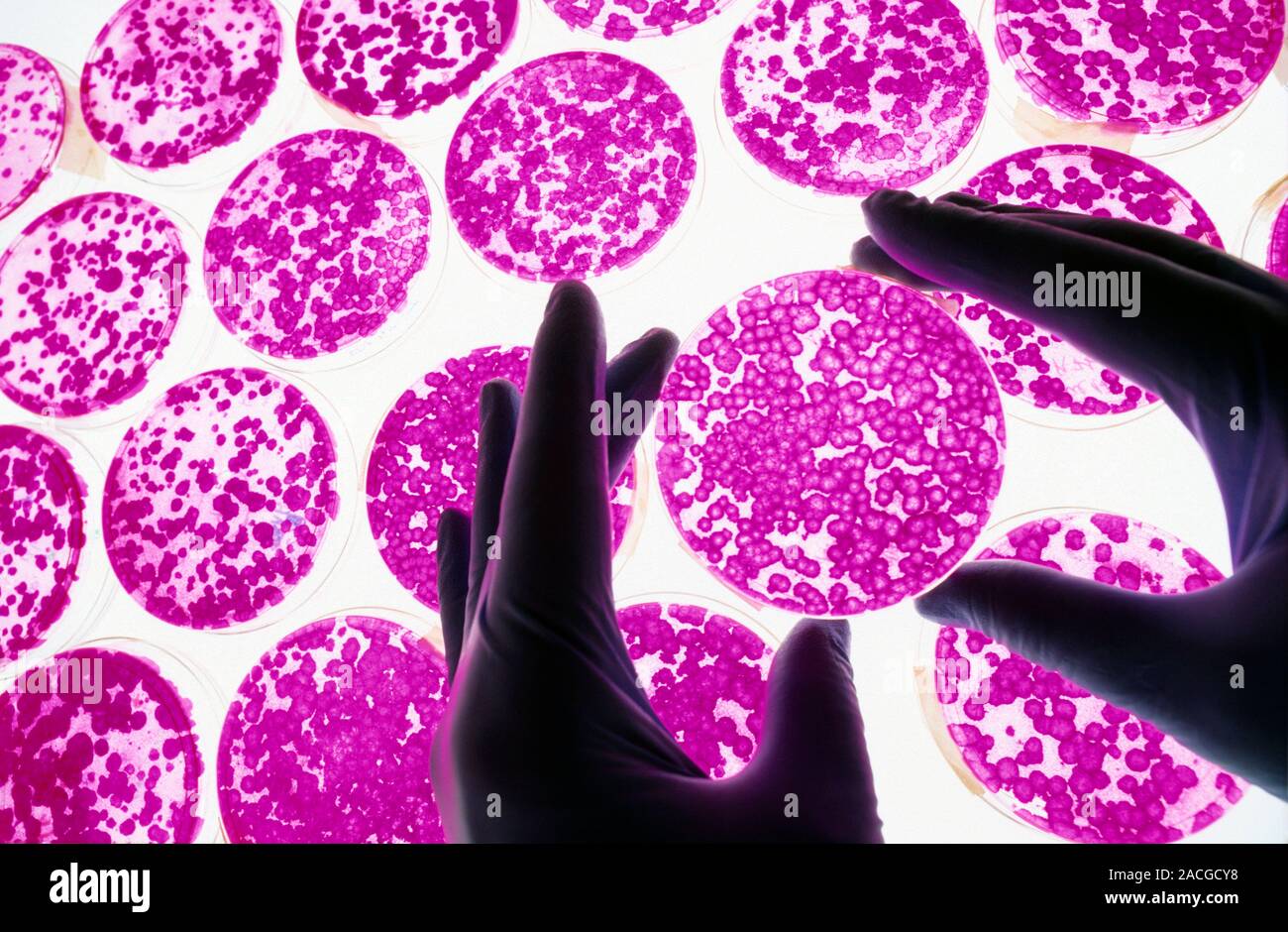 Stem cell research. Cultures of stem cells growing in petri dishes ...