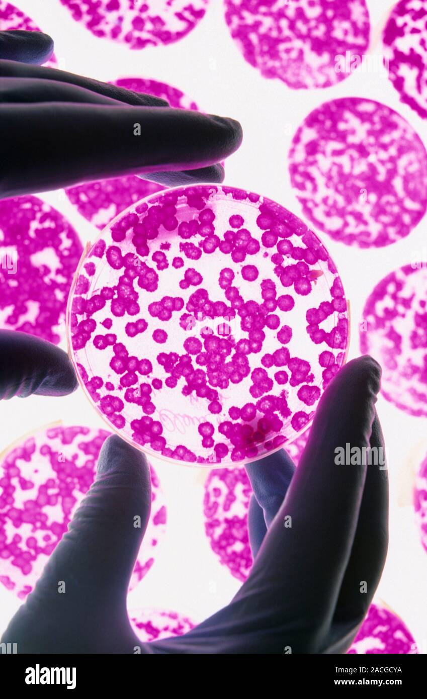 Stem cell research. Cultures of stem cells growing in petri dishes ...