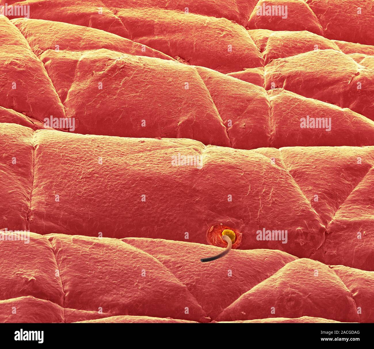 Skin surface. Coloured scanning electron micrograph (SEM) of the ...