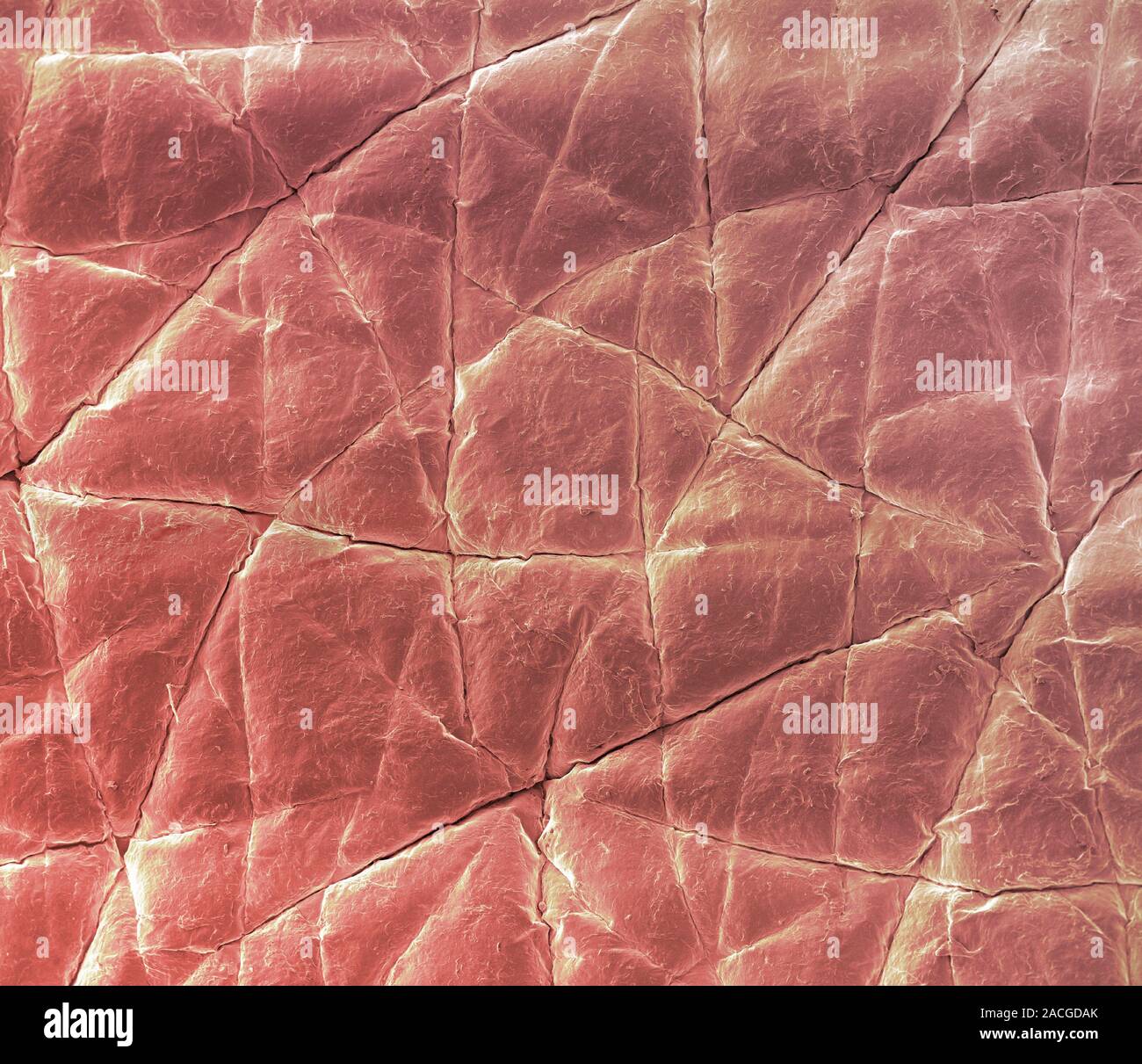 Skin surface. Coloured scanning electron micrograph (SEM) of the ...