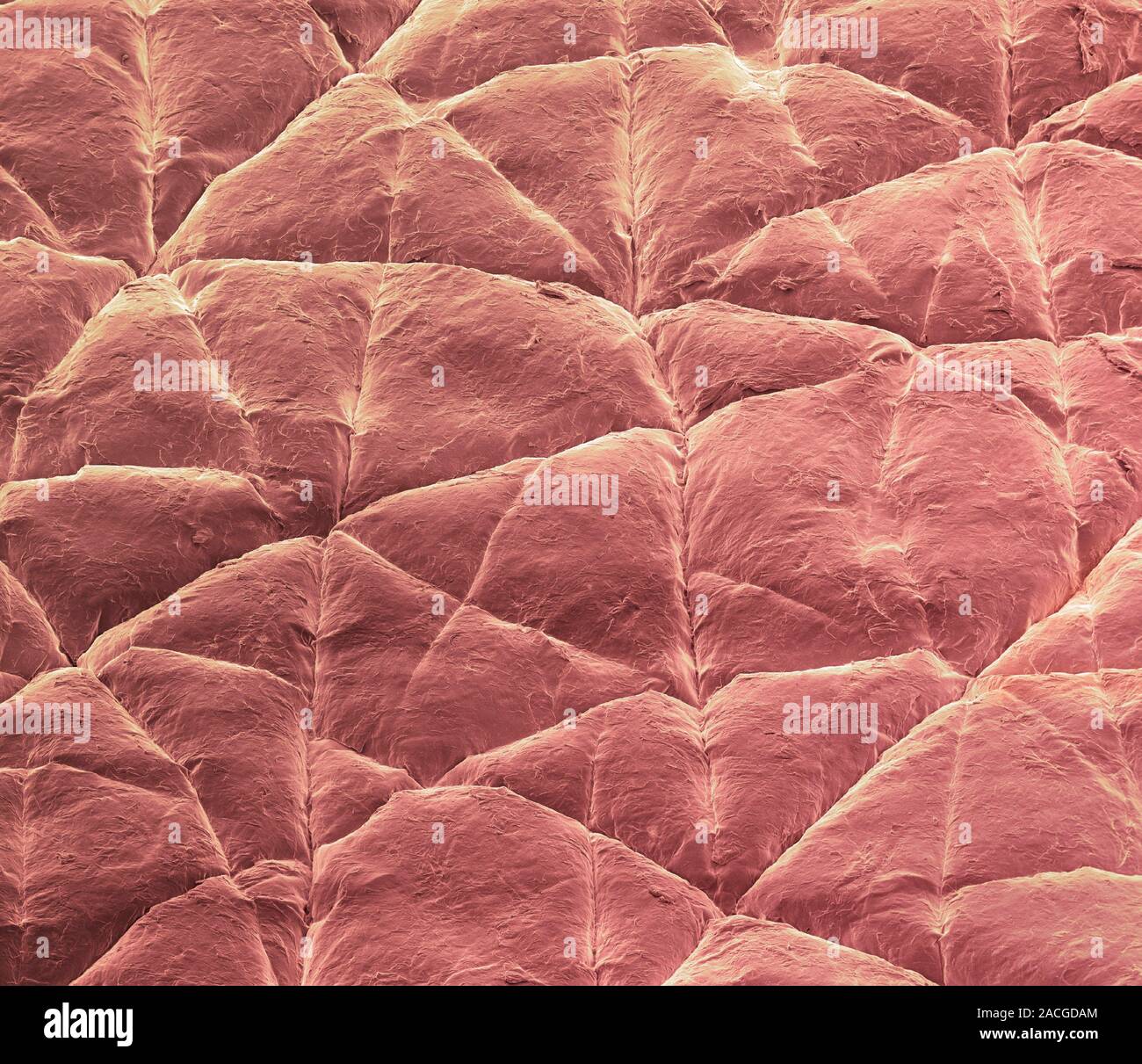 Skin surface. Coloured scanning electron micrograph (SEM) of the ...
