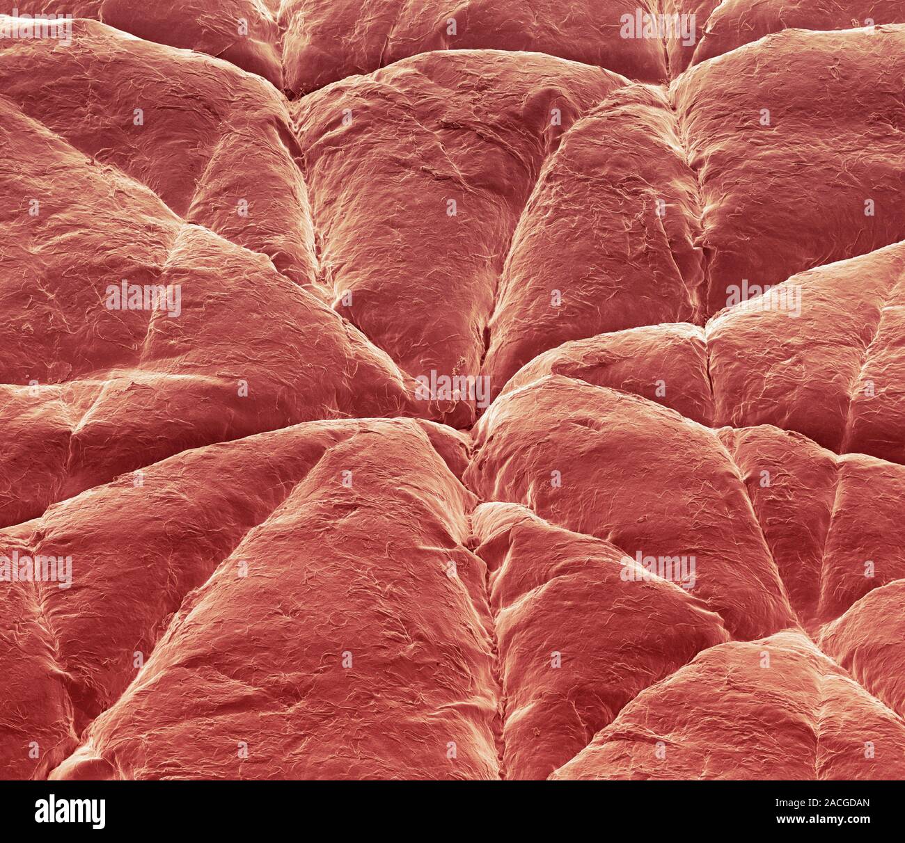 Skin surface. Coloured scanning electron micrograph (SEM) of the ...