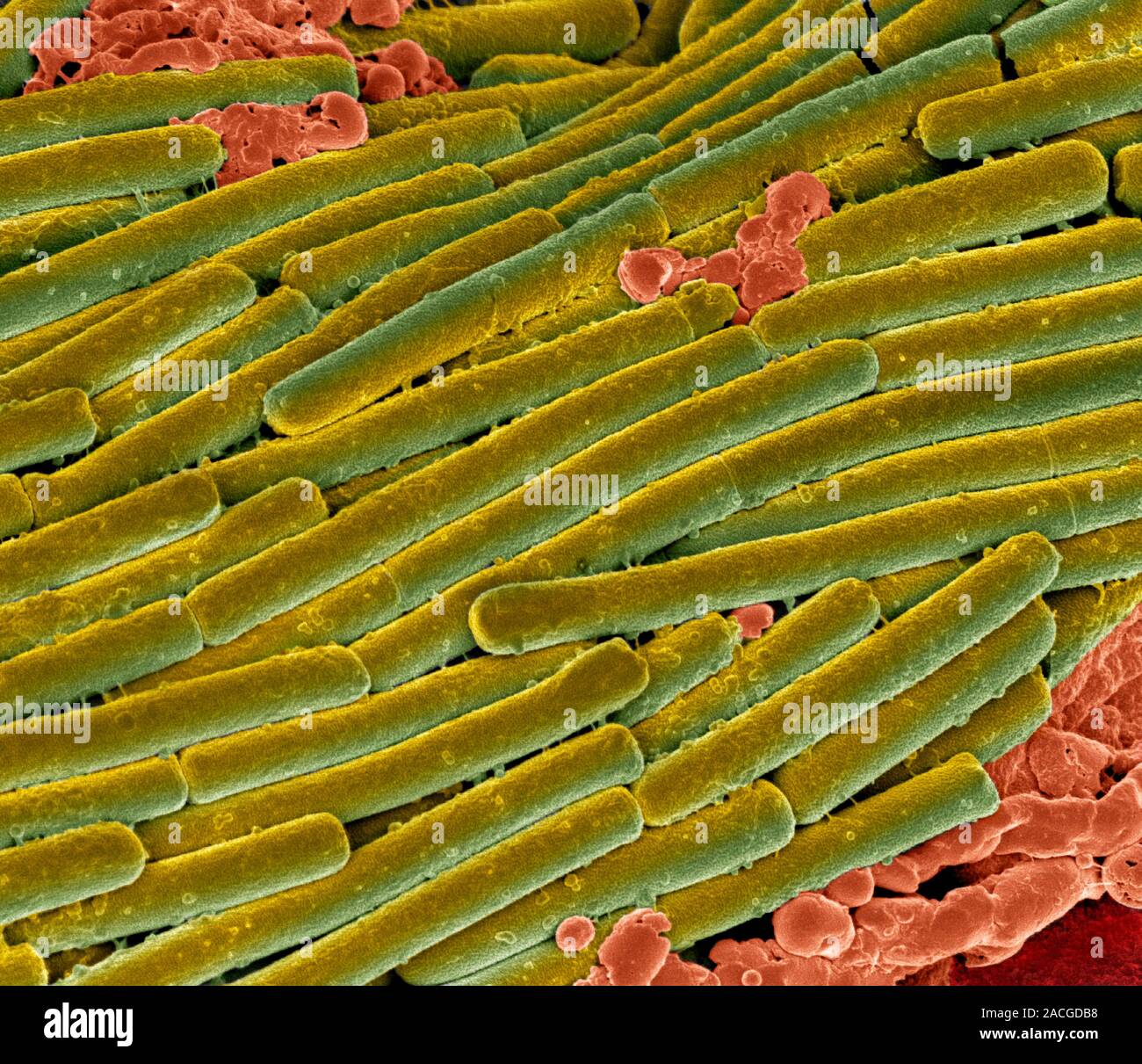 Clostridium difficile bacteria. Coloured scanning electron micrograph ...