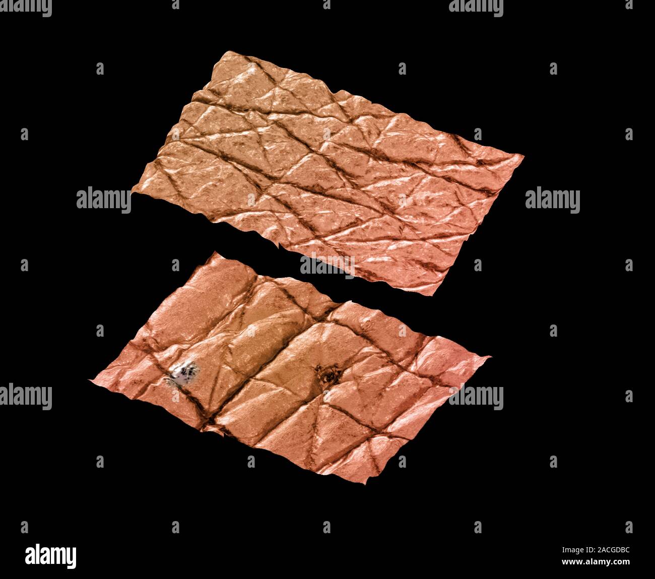 Skin surface comparison. Coloured 3-D light micrograph comparing the ...