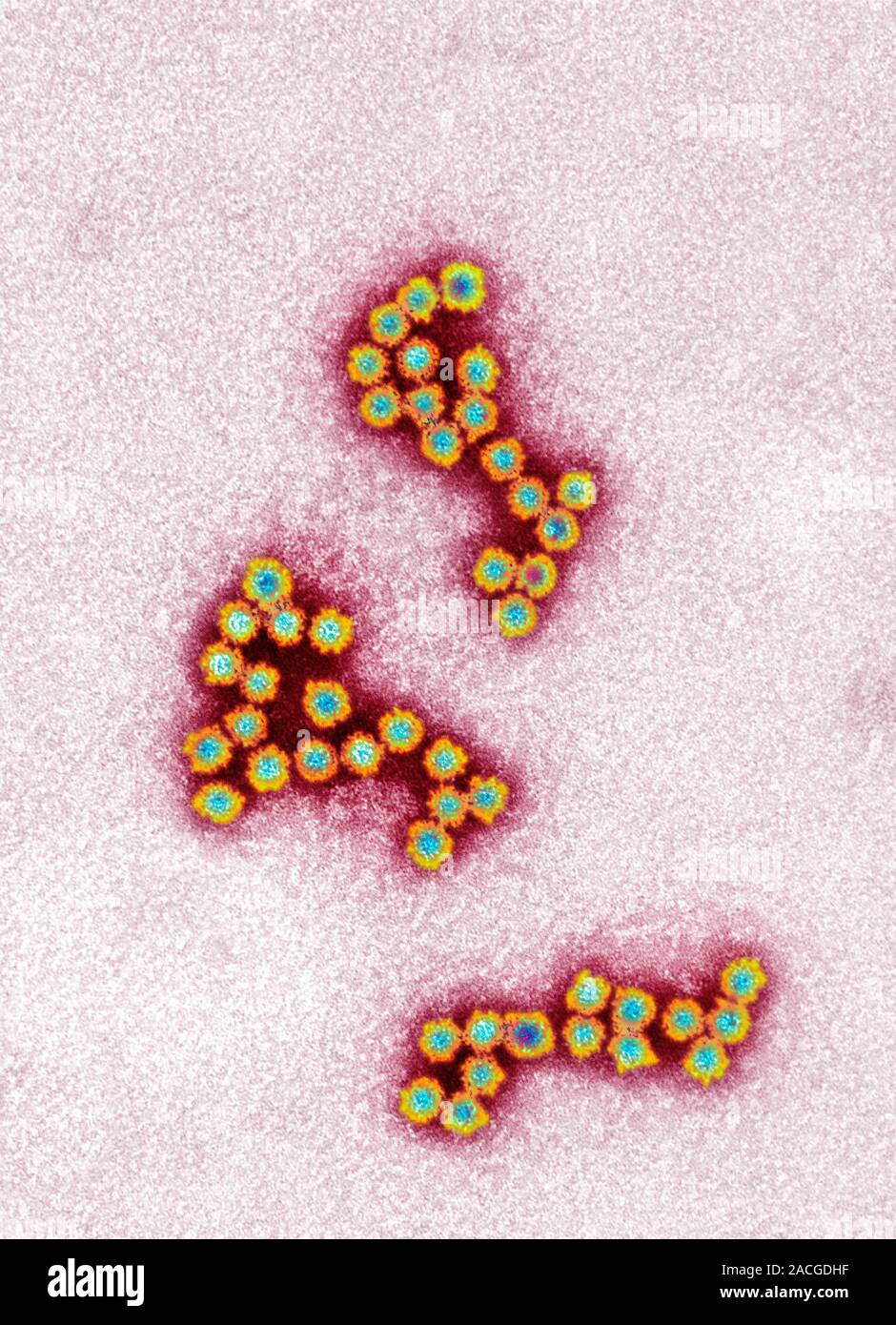 Norovirus particles. Coloured transmission electron micrograph (TEM) of ...