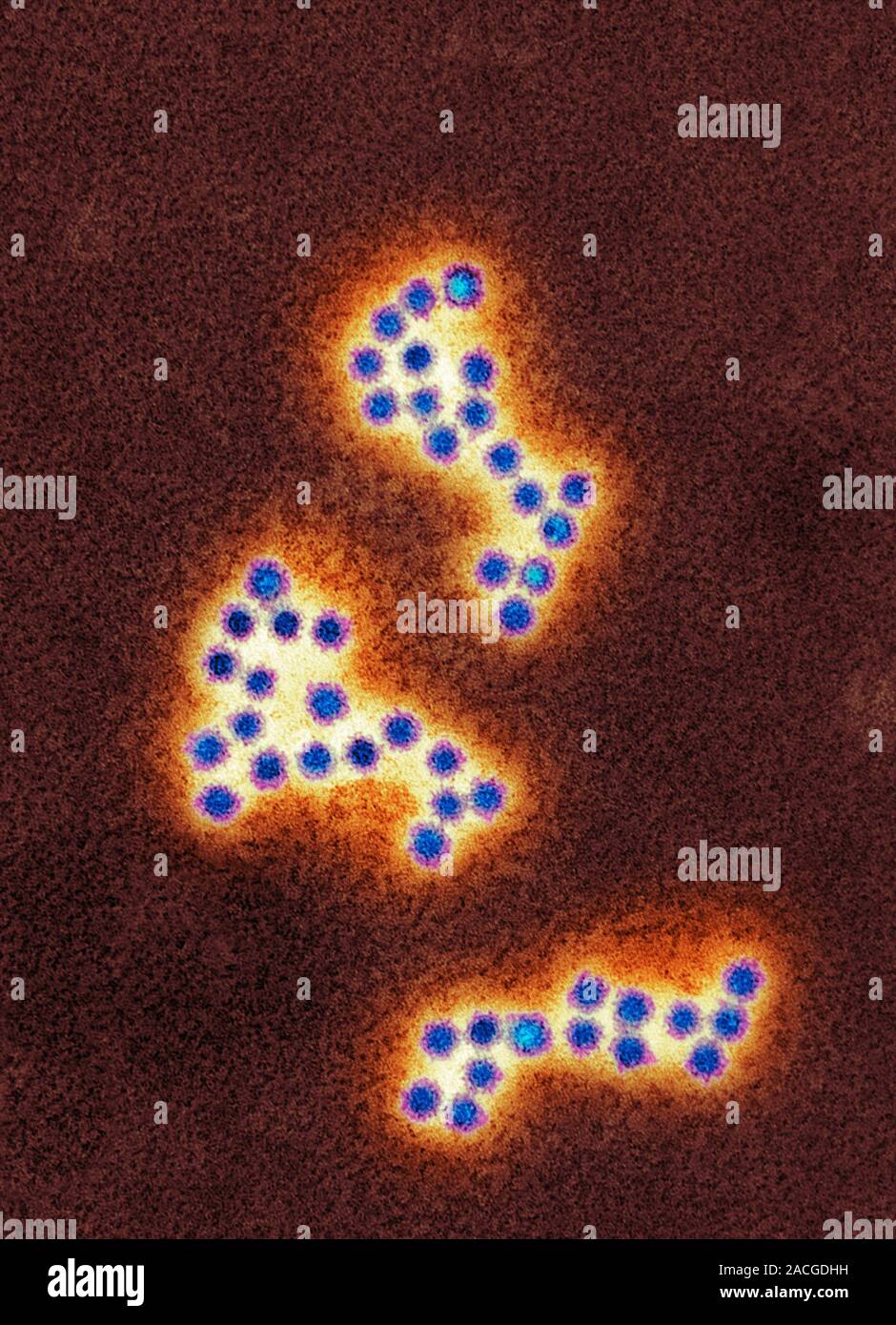 Norovirus particles. Coloured transmission electron micrograph (TEM) of ...