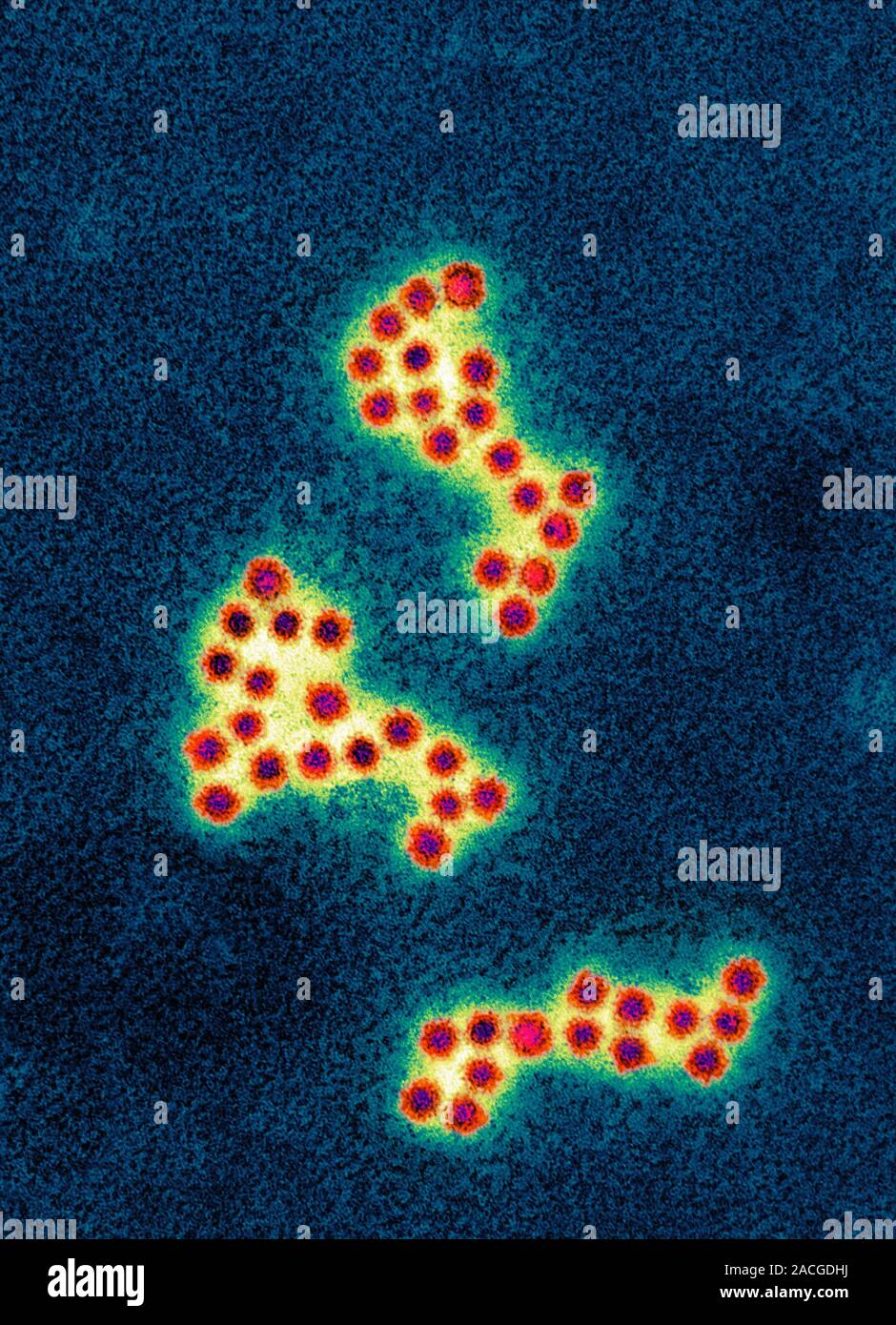 Norovirus particles. Coloured transmission electron micrograph (TEM) of ...