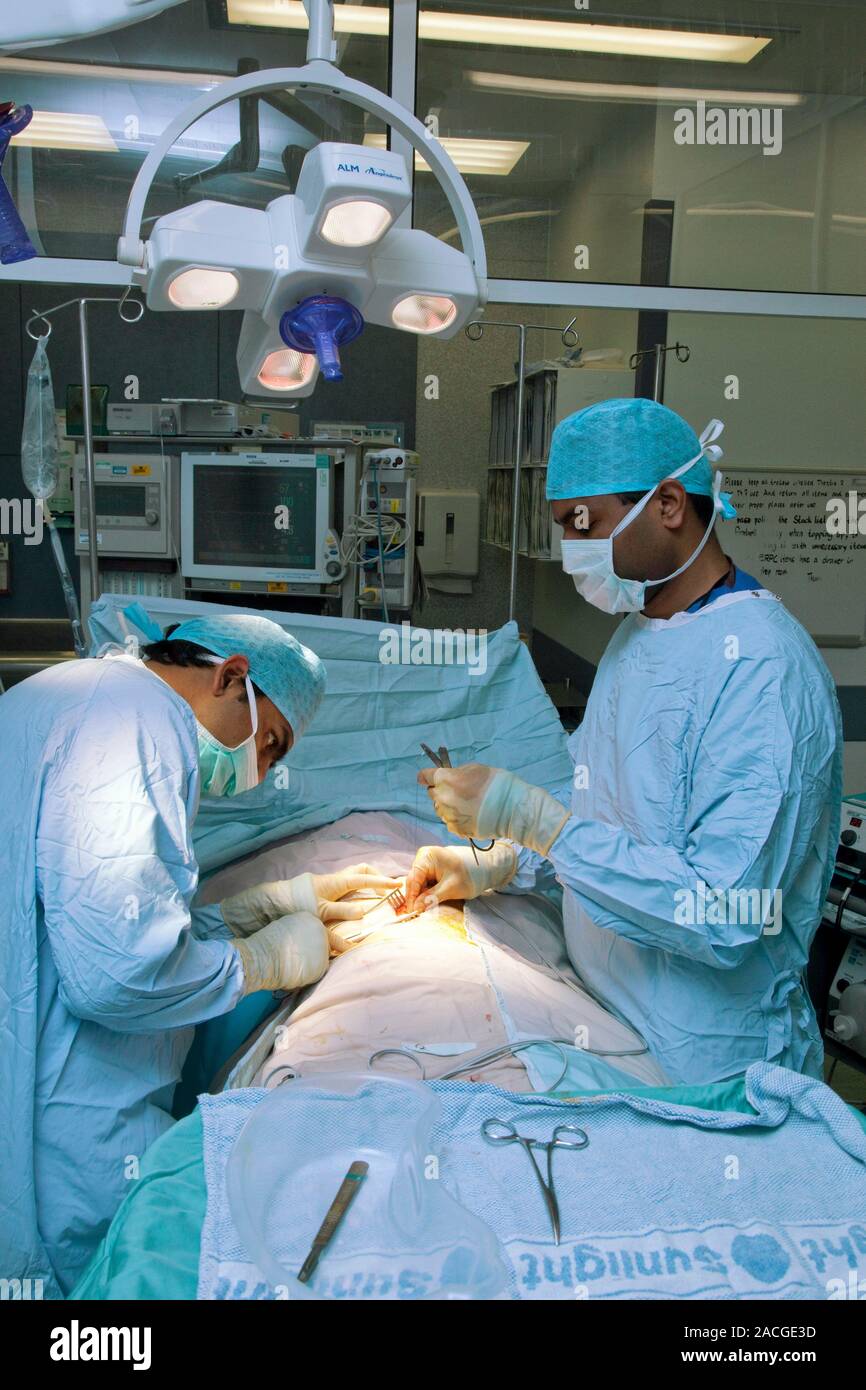 Hernia operation. Surgeons performing surgery to repair an epigastric ...