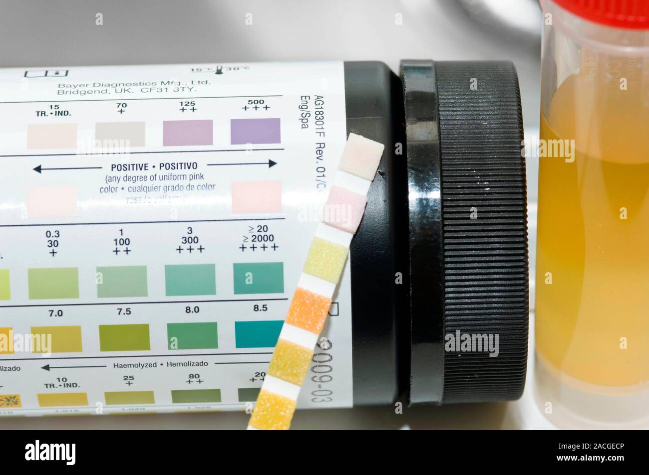 Multistix urine dipstick showing positive 'nitrites' (pink) in a ...