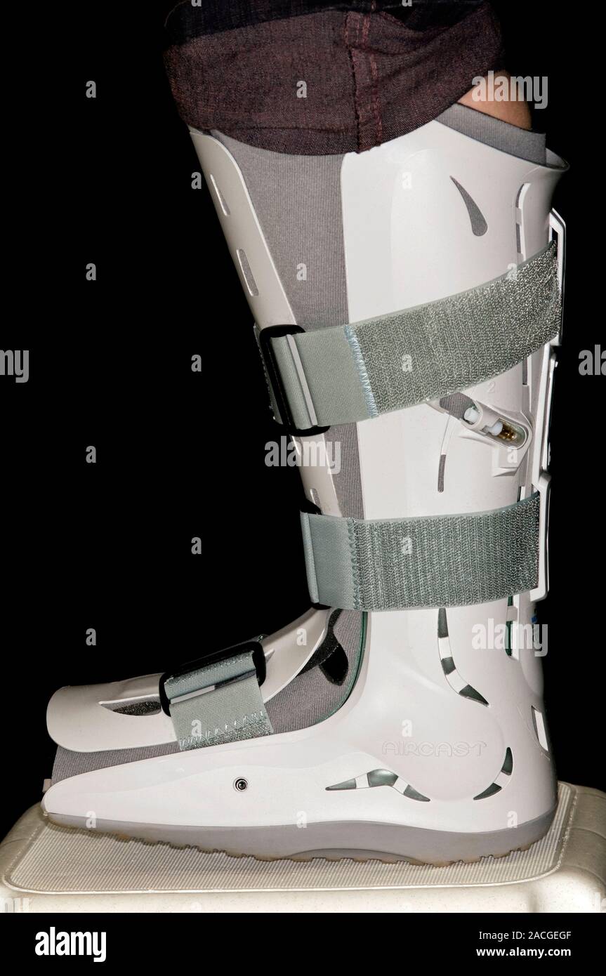 Foot of a 45 year old female patient wearing a lightweight supportive ...