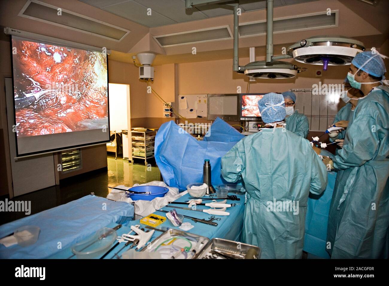 Laparoscopic prostate surgery. Surgeons using laparoscopes inserted ...