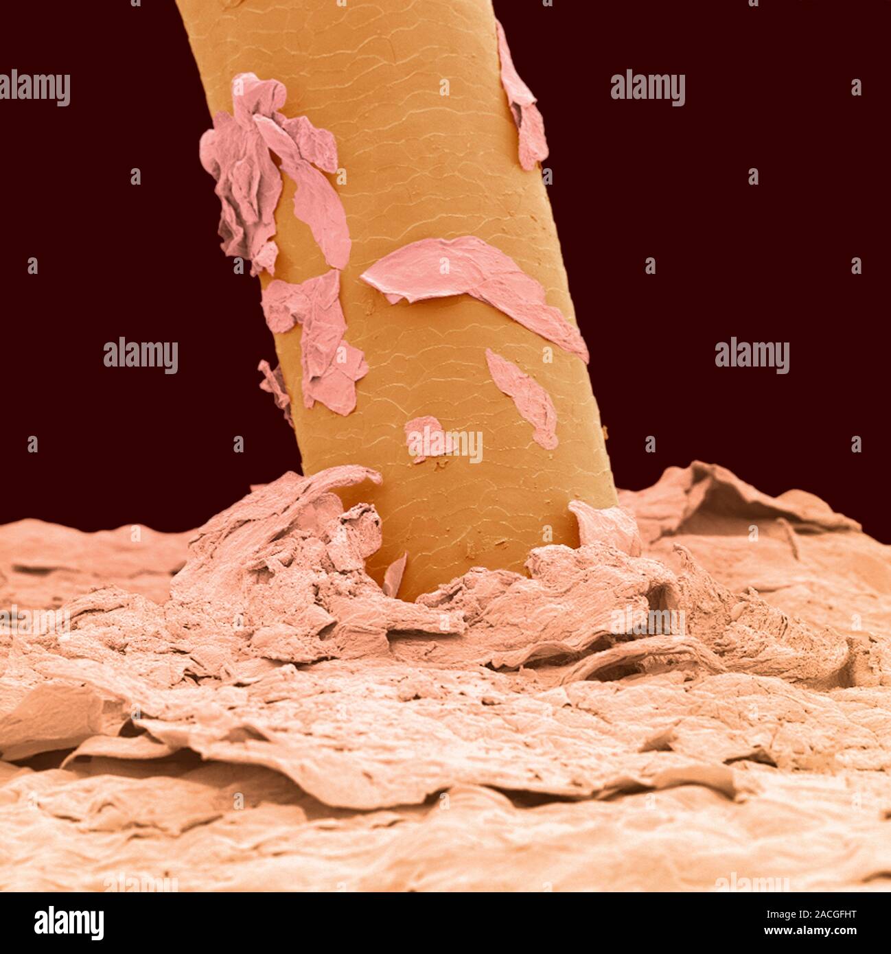 Eyelash, coloured scanning electron micrograph (SEM). Eyelashes are ...