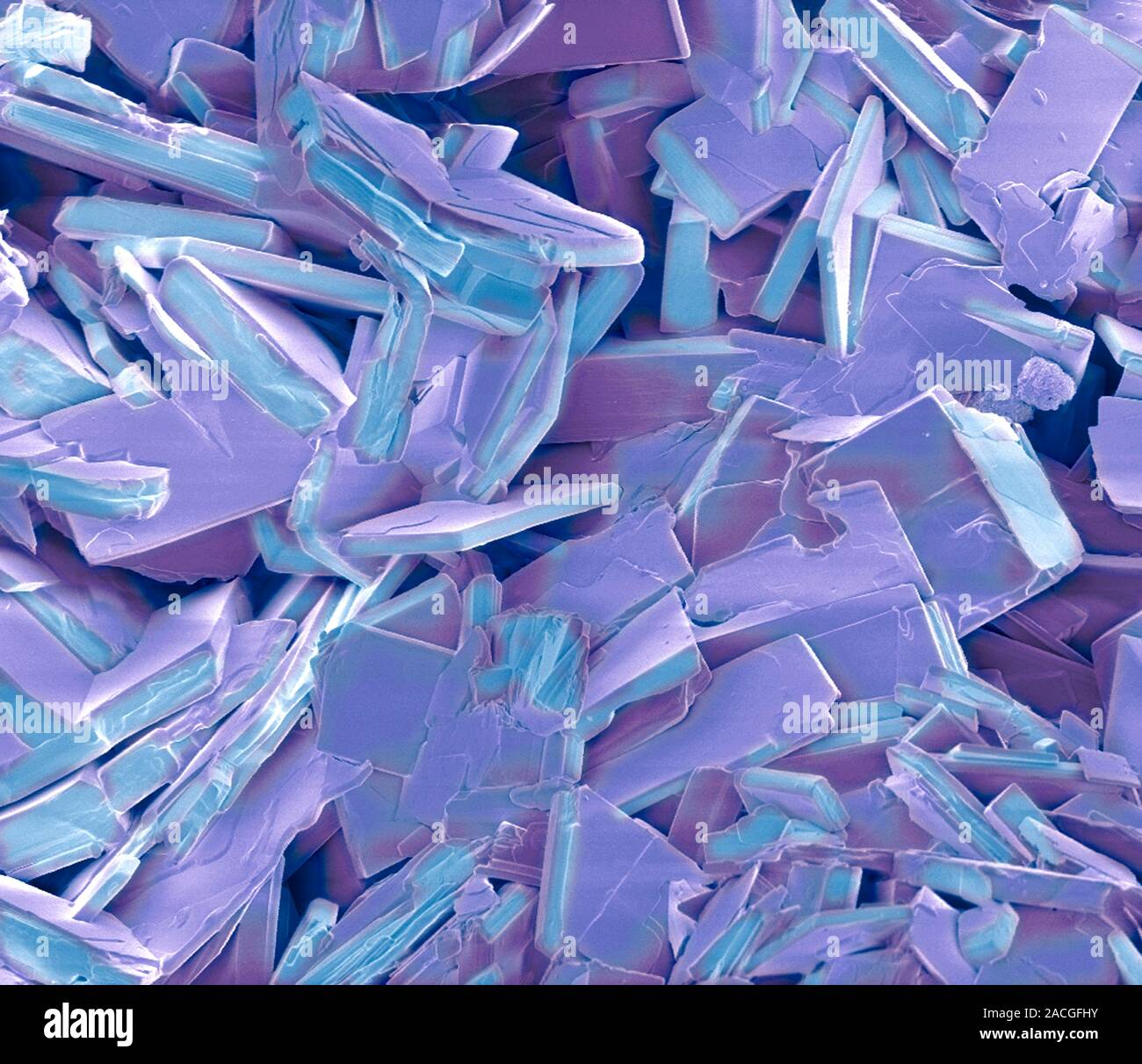 Gallstone crystals. Coloured scanning electron micrograph (SEM) of the ...