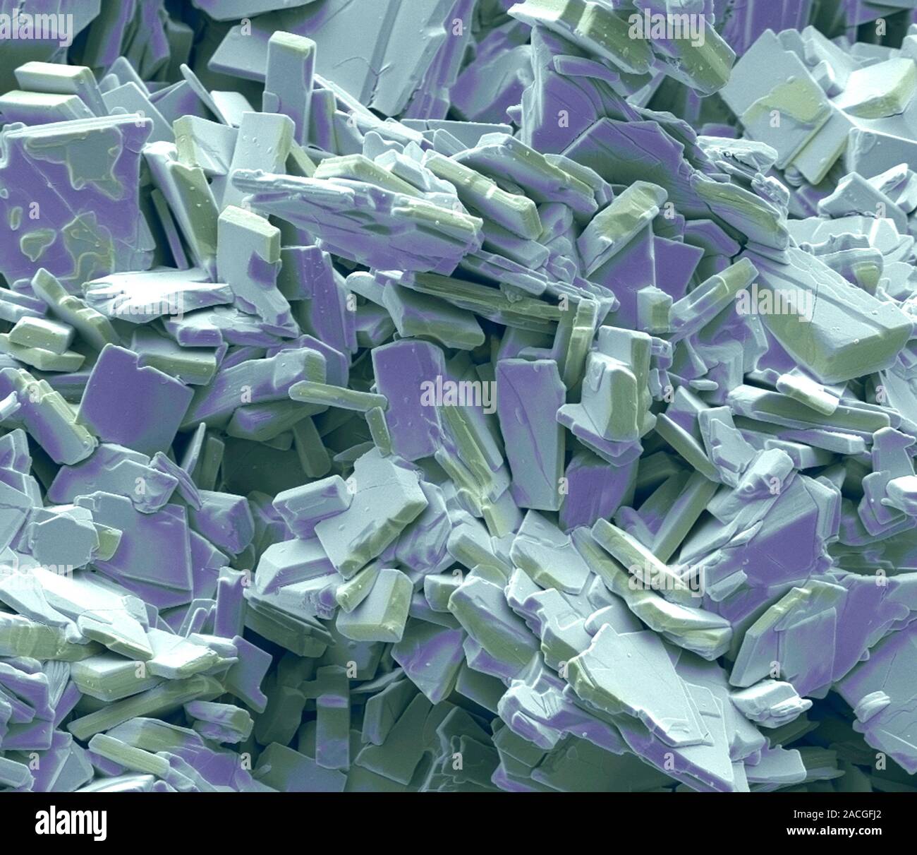 Gallstone crystals. Coloured scanning electron micrograph (SEM) of the ...