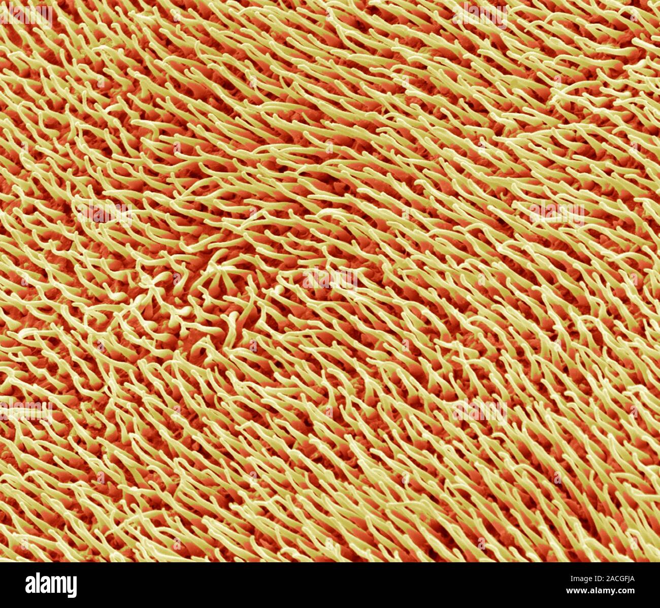 Gecko scale hairs. Coloured scanning electron micrograph (SEM) of hairs ...
