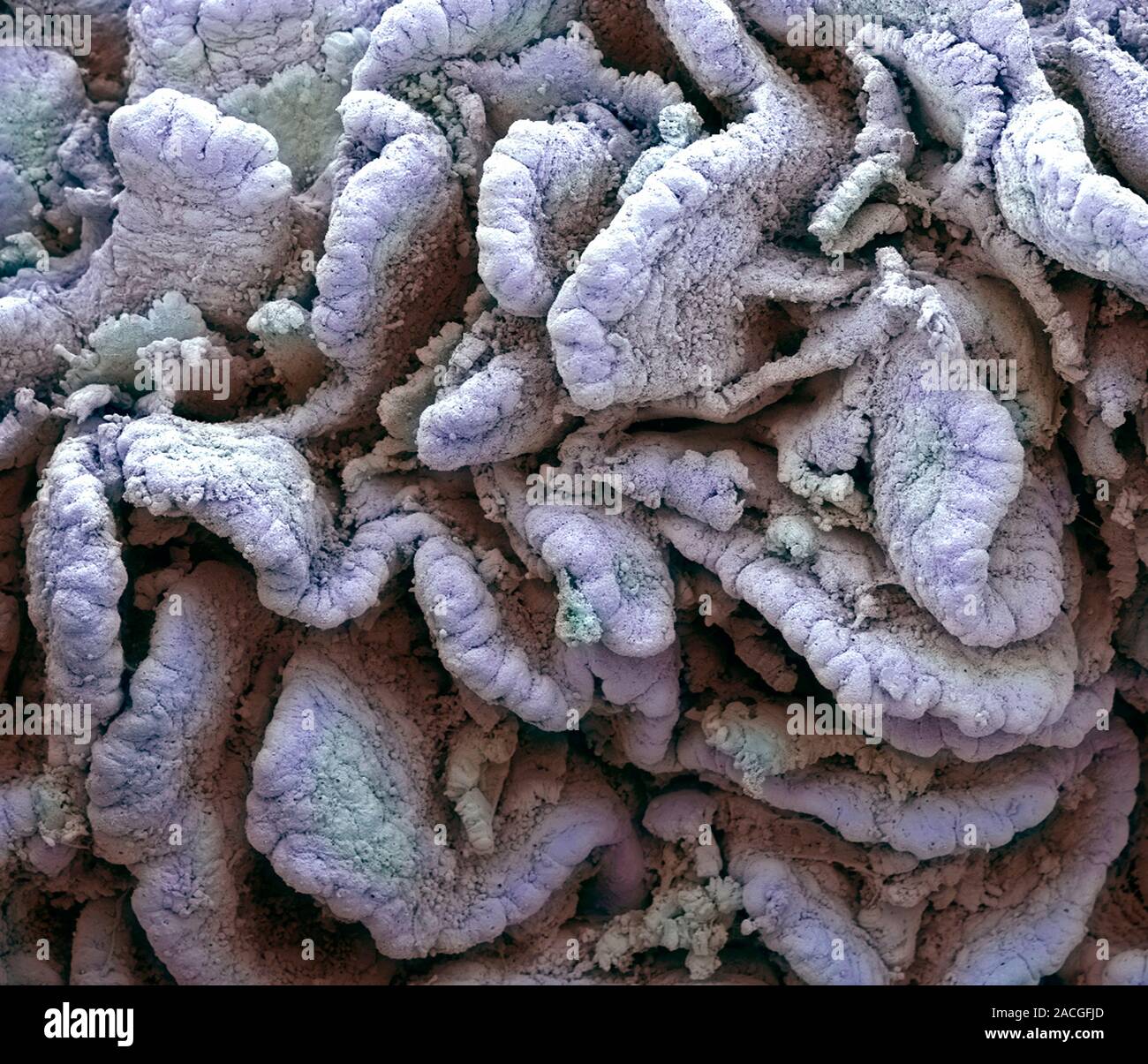 Intestinal villi. Coloured scanning micrograph (SEM) of villi (rounded ...