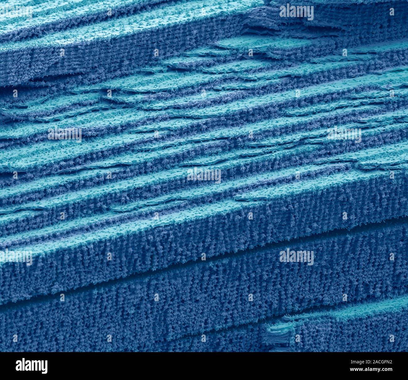 Eye lens fibres. Coloured scanning electron micrograph (SEM) of a ...