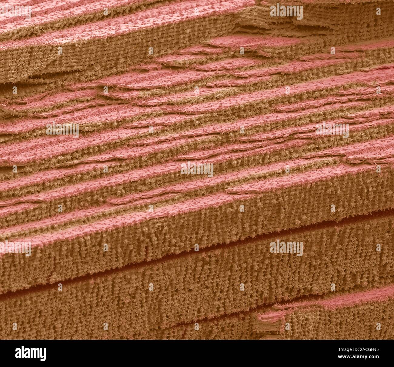 Eye lens fibres. Coloured scanning electron micrograph (SEM) of a ...