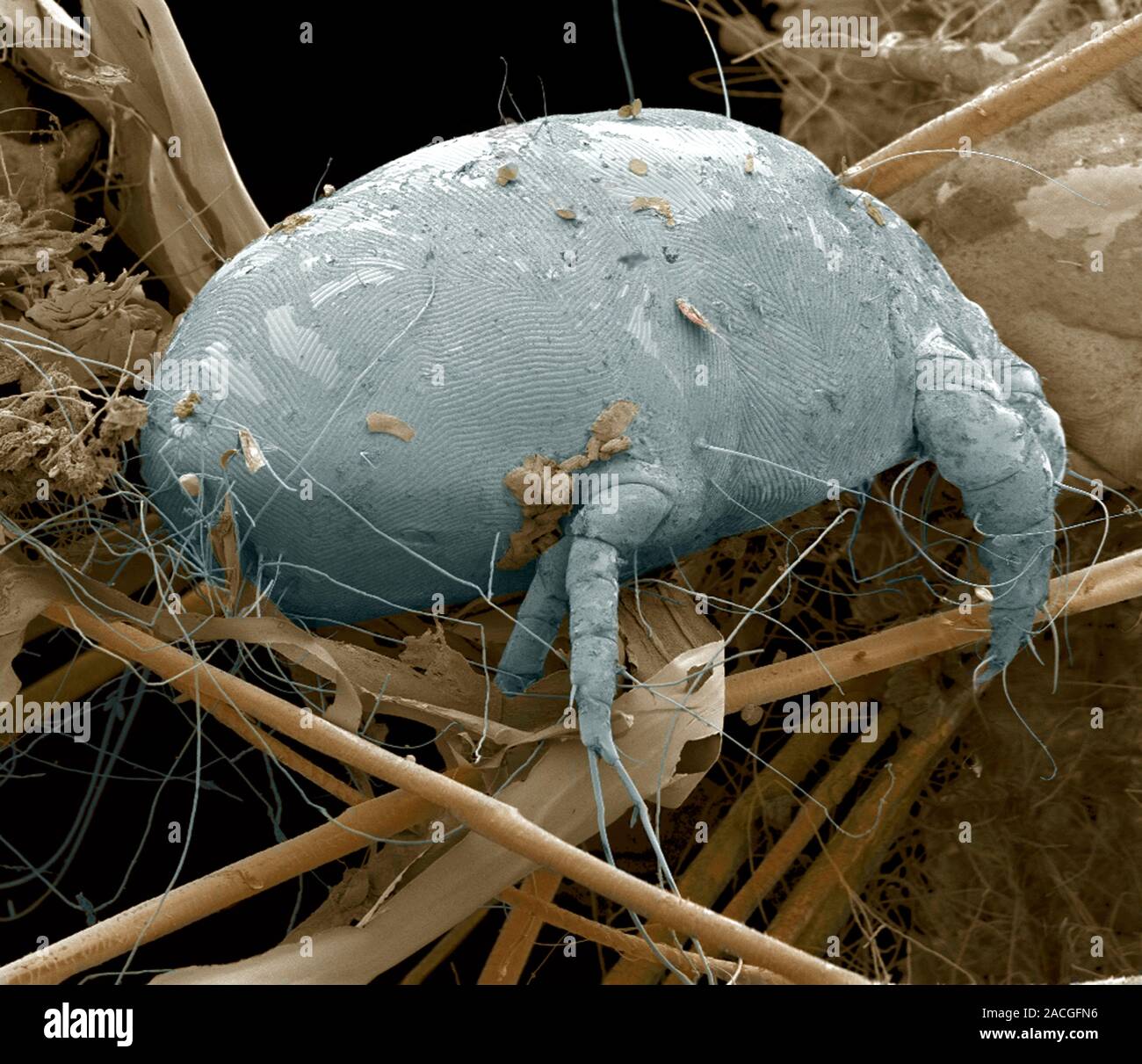 Mange mite. Coloured scanning electron micrograph (SEM) of a mite ...
