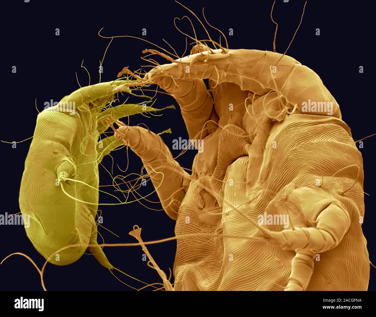 Mange mites. Coloured scanning electron micrograph (SEM) of two mites ...