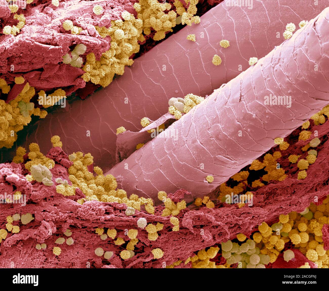 Lymphocytes in hair follicle, coloured scanning electron micrograph ...
